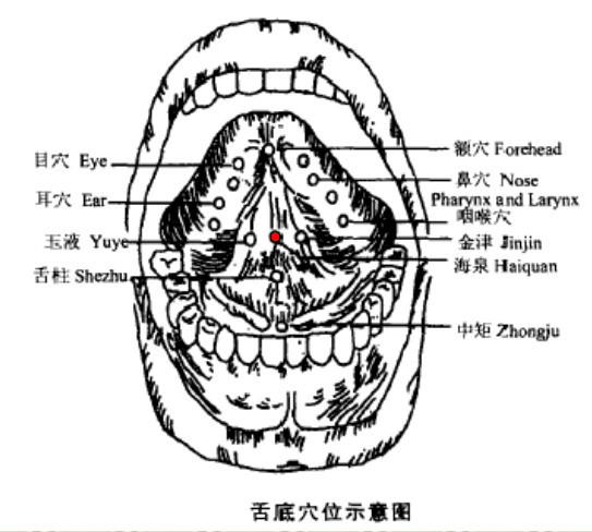 Haiquan - TCM Wiki