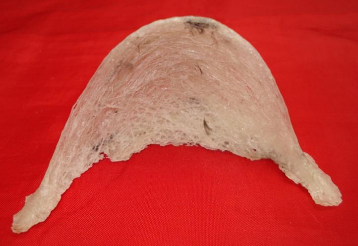 Yan Wo - TCM Herbs - TCM Wiki