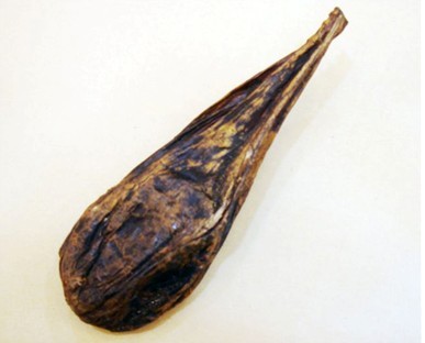 Xiong Dan - TCM Herbs - TCM Wiki